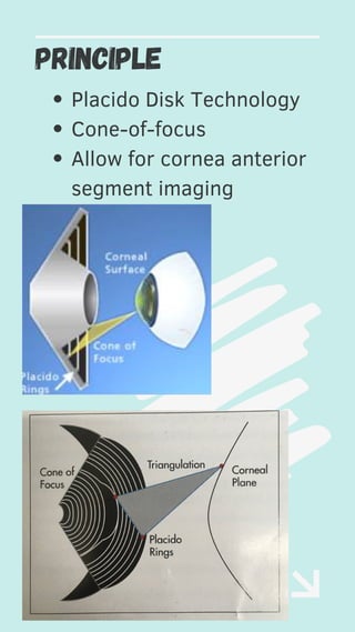 A quick revision on Corneal topography | PDF