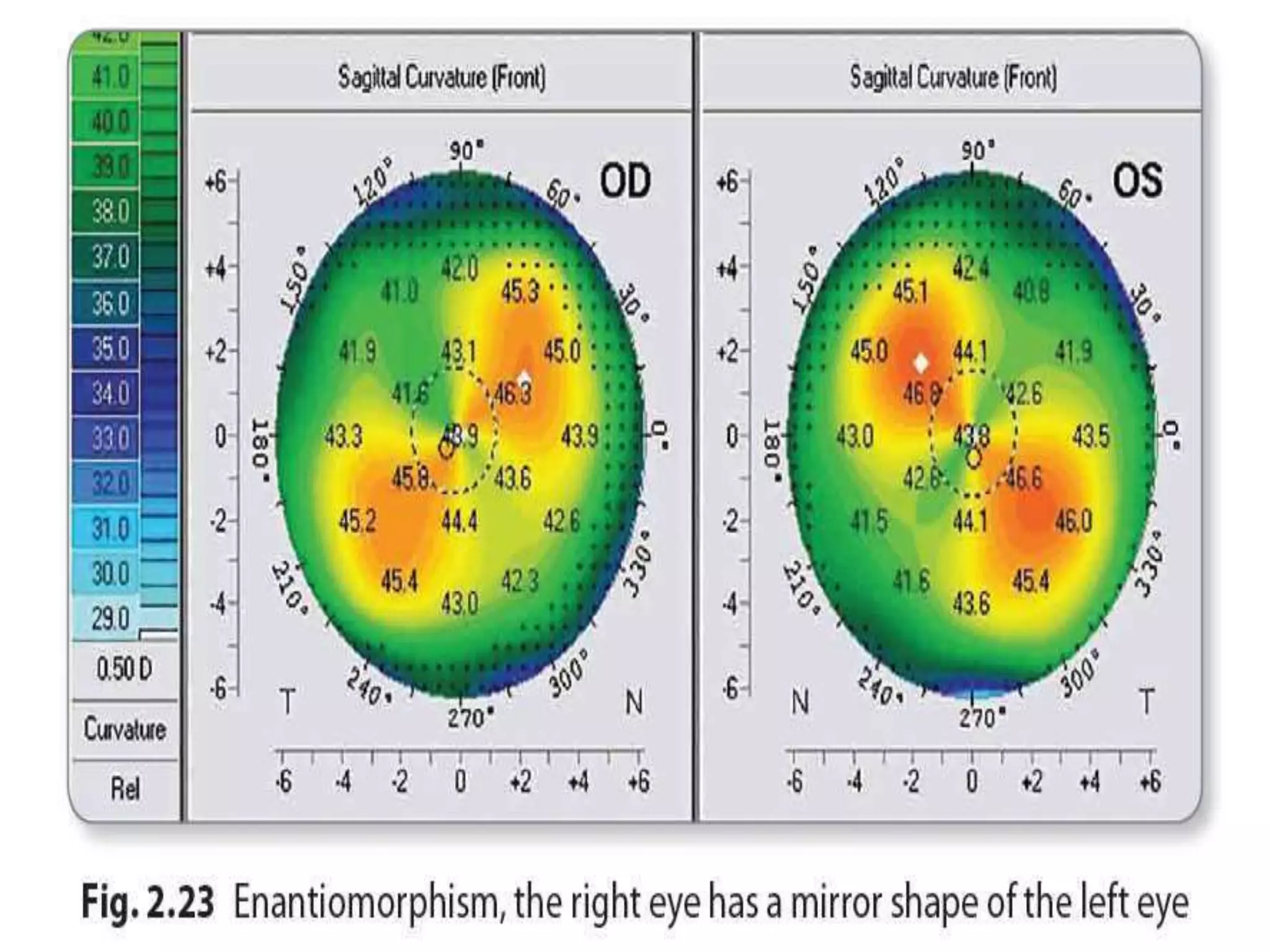 Corneal topography final | PPTX