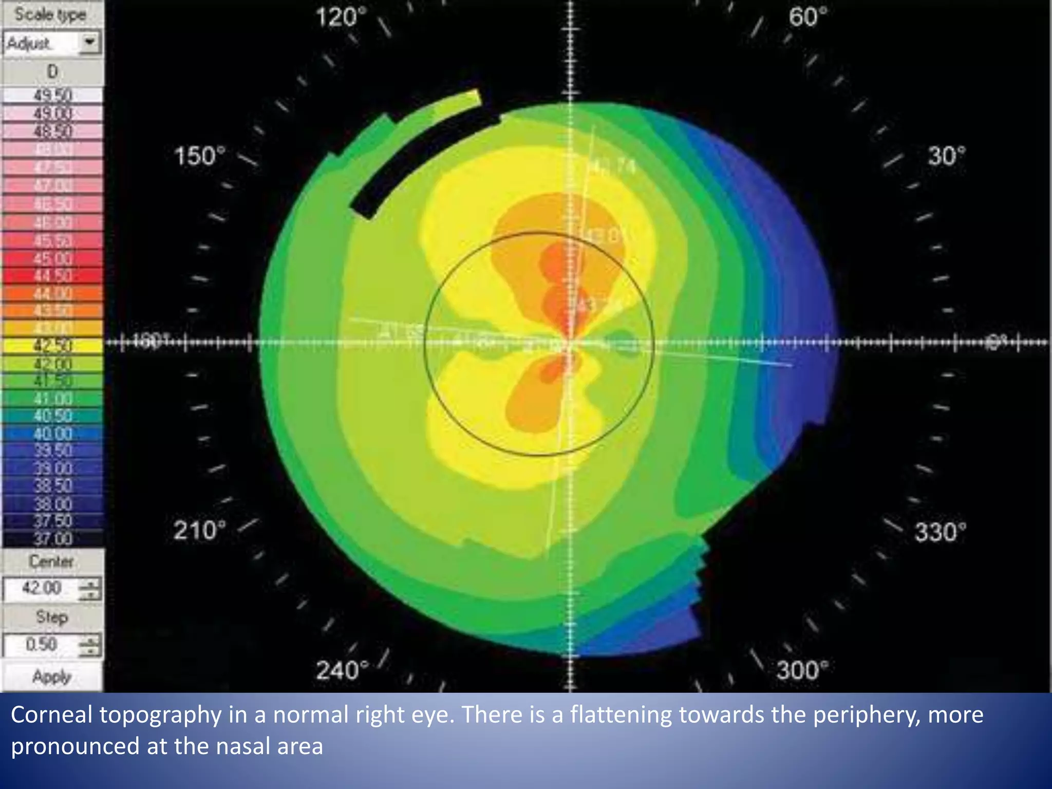 Corneal topography final | PPTX