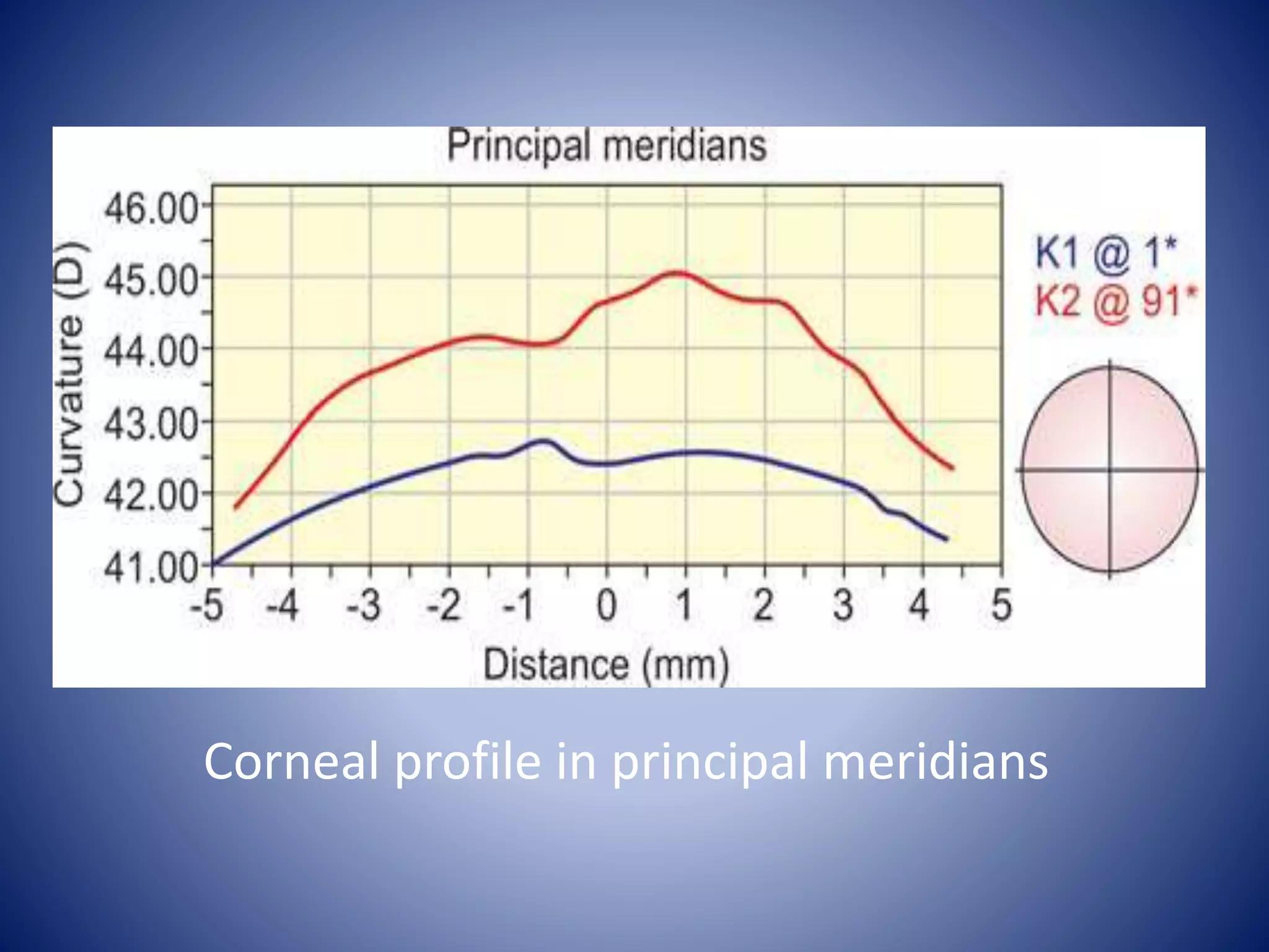 Corneal topography final | PPTX