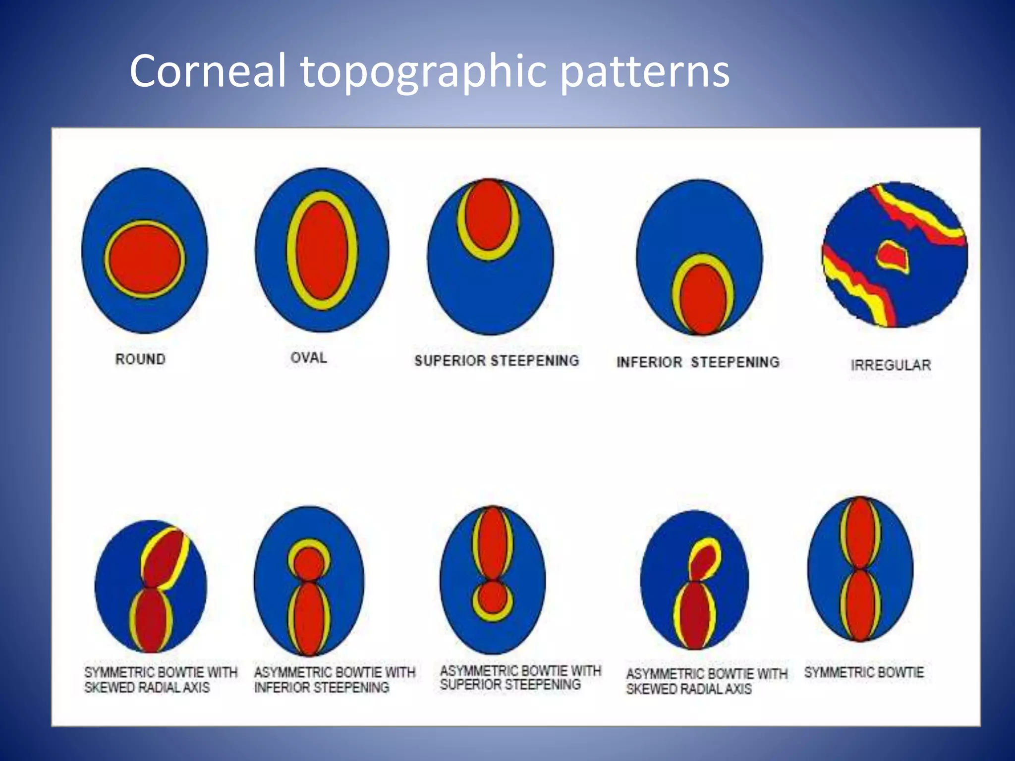 Corneal topography final | PPTX