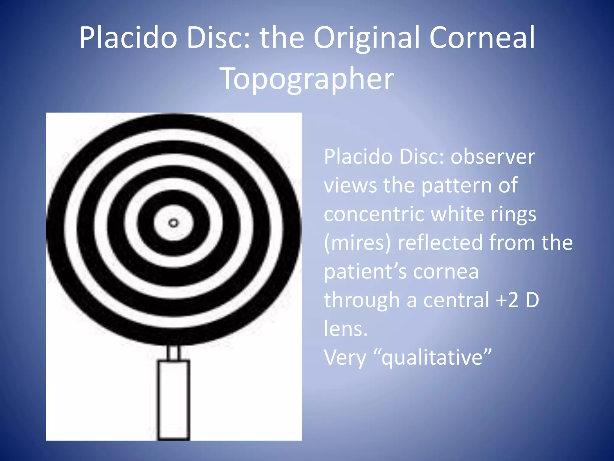 Corneal topography final | PPTX