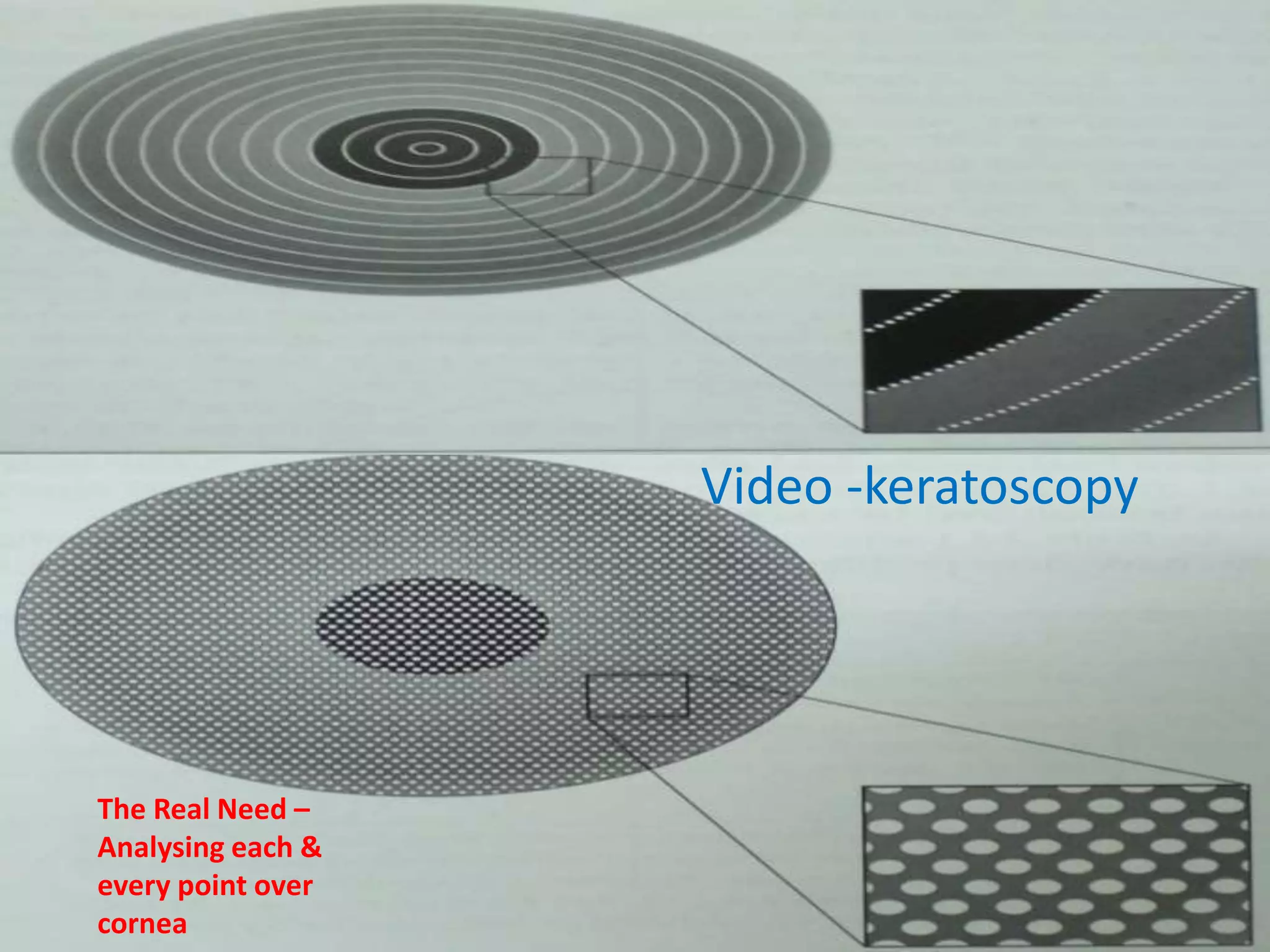 Corneal topography final | PPTX