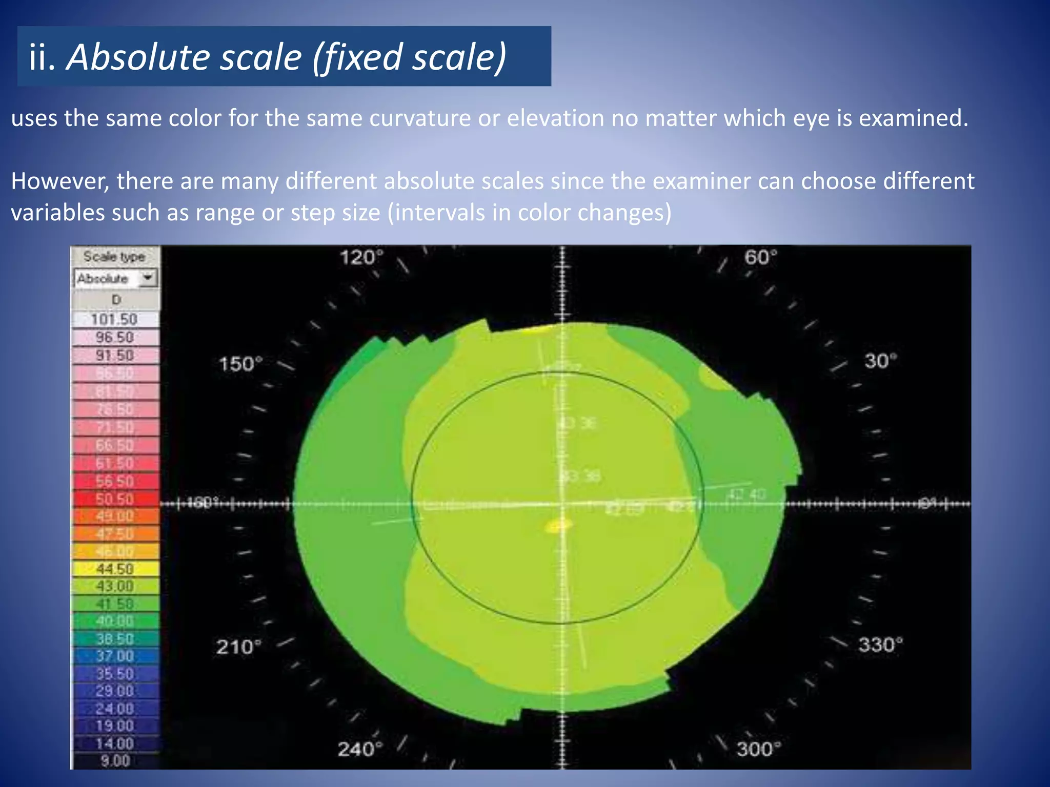 Corneal topography final | PPTX