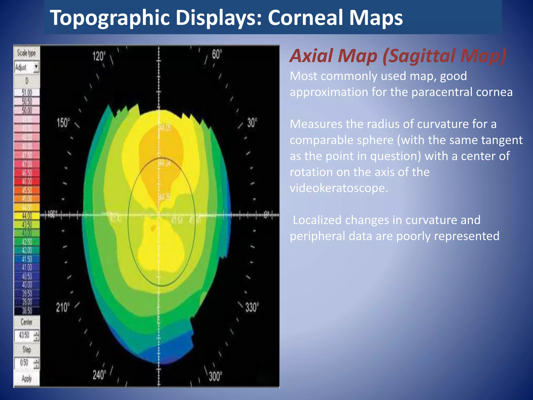 Corneal topography final | PPTX