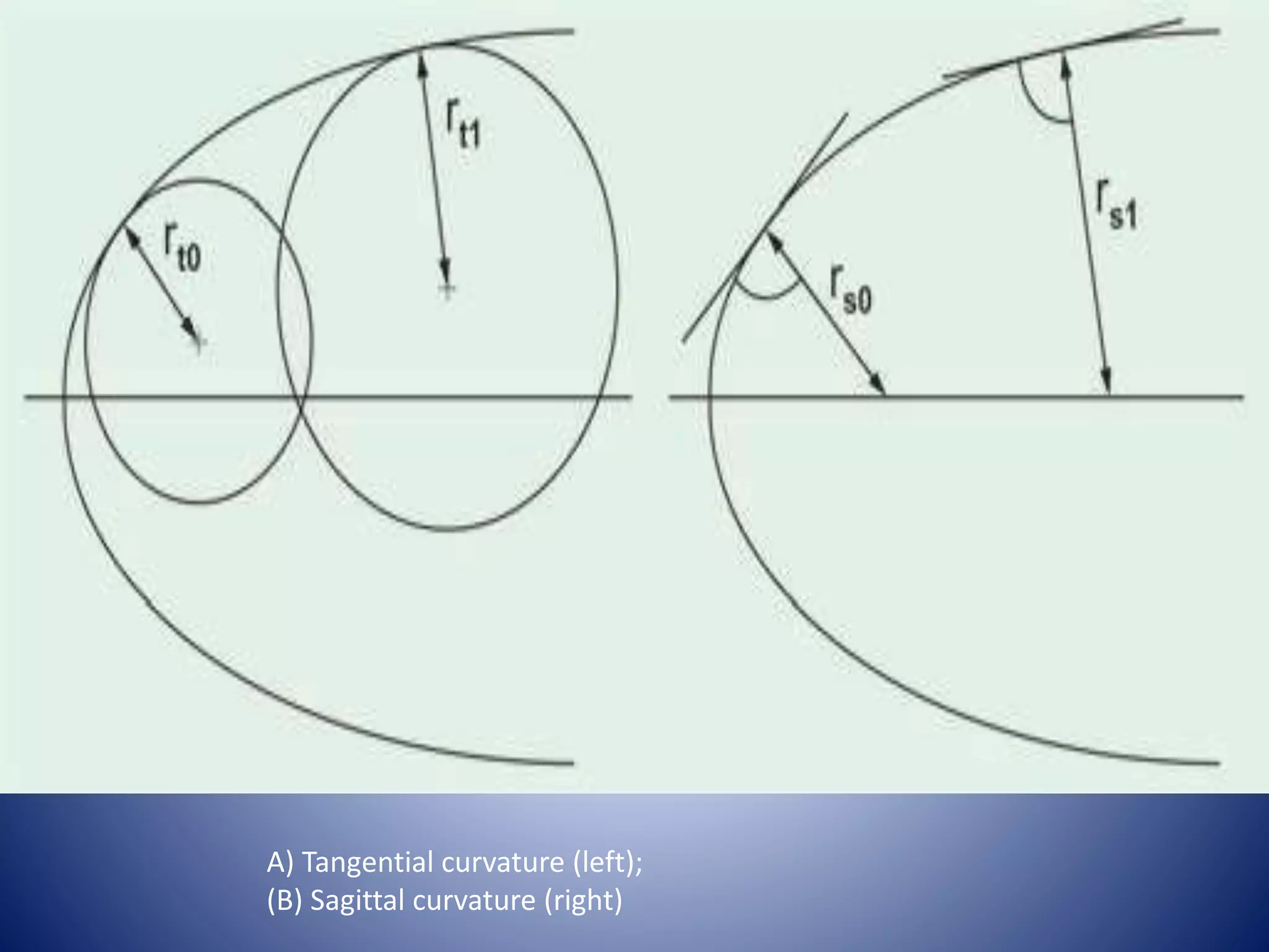 Corneal topography final | PPTX