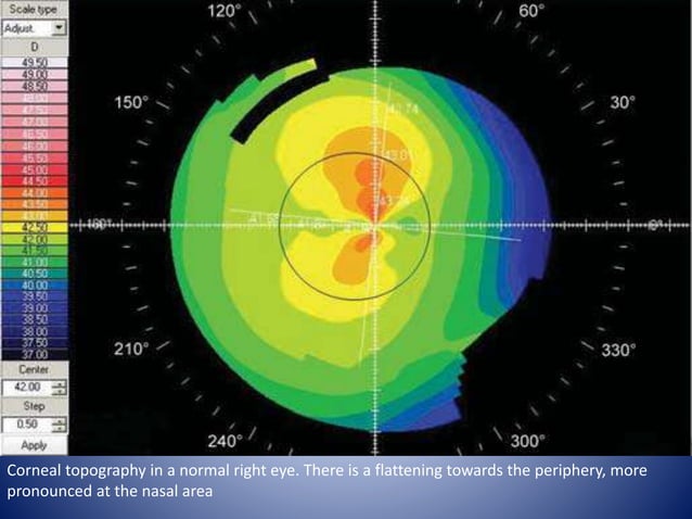 Corneal topography final | PPTX
