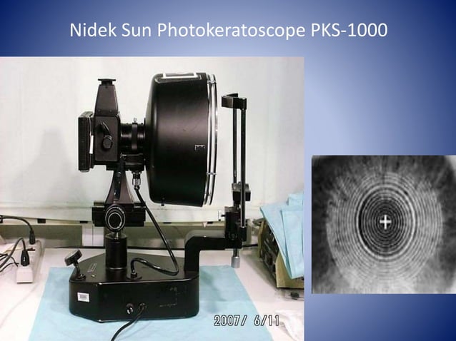 Corneal topography final | PPTX