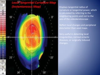 Corneal topography final | PPTX