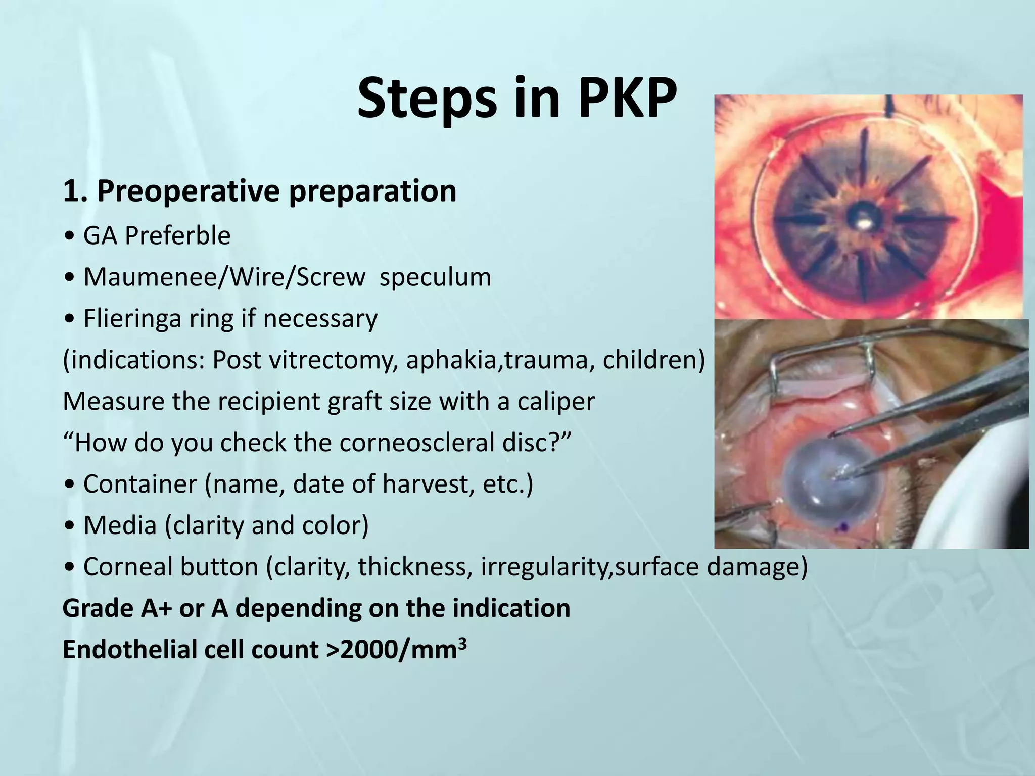 Corneal transplantation | PPTX