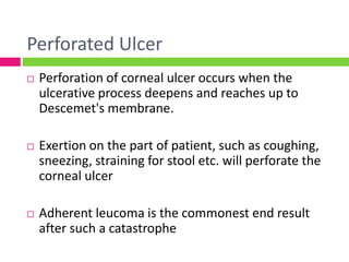 corneal ulcer.pptx