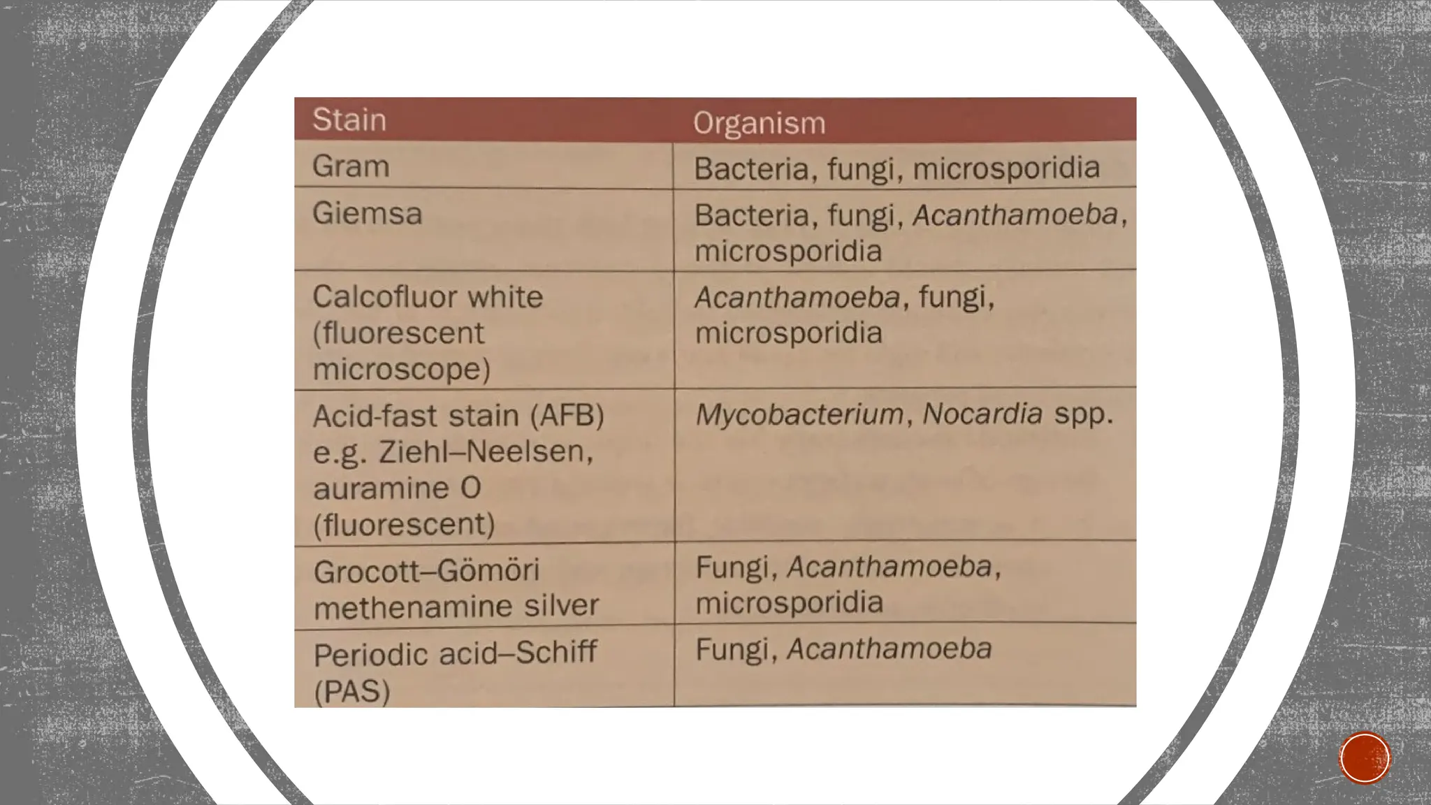 Corneal Ulcer Bacterial Fungal Acanthamoeba Pptx