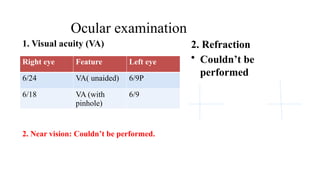 Case presentation on topic Corneal ulcer.pptx