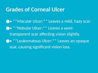 cornefgyfyuuteryureryuteryy4al ulcer .pptx