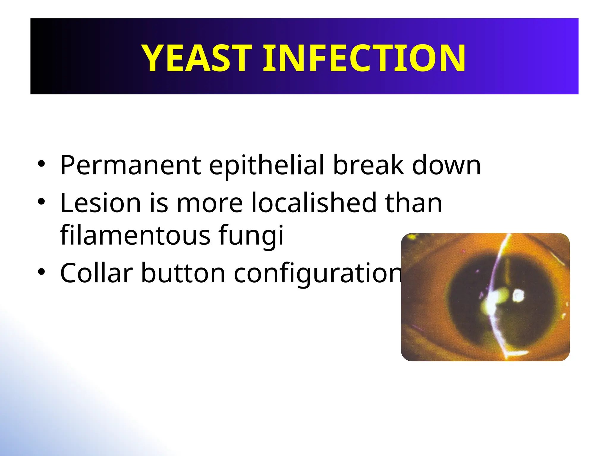 Human being eye CORNEAL ULCER explanation.pptx