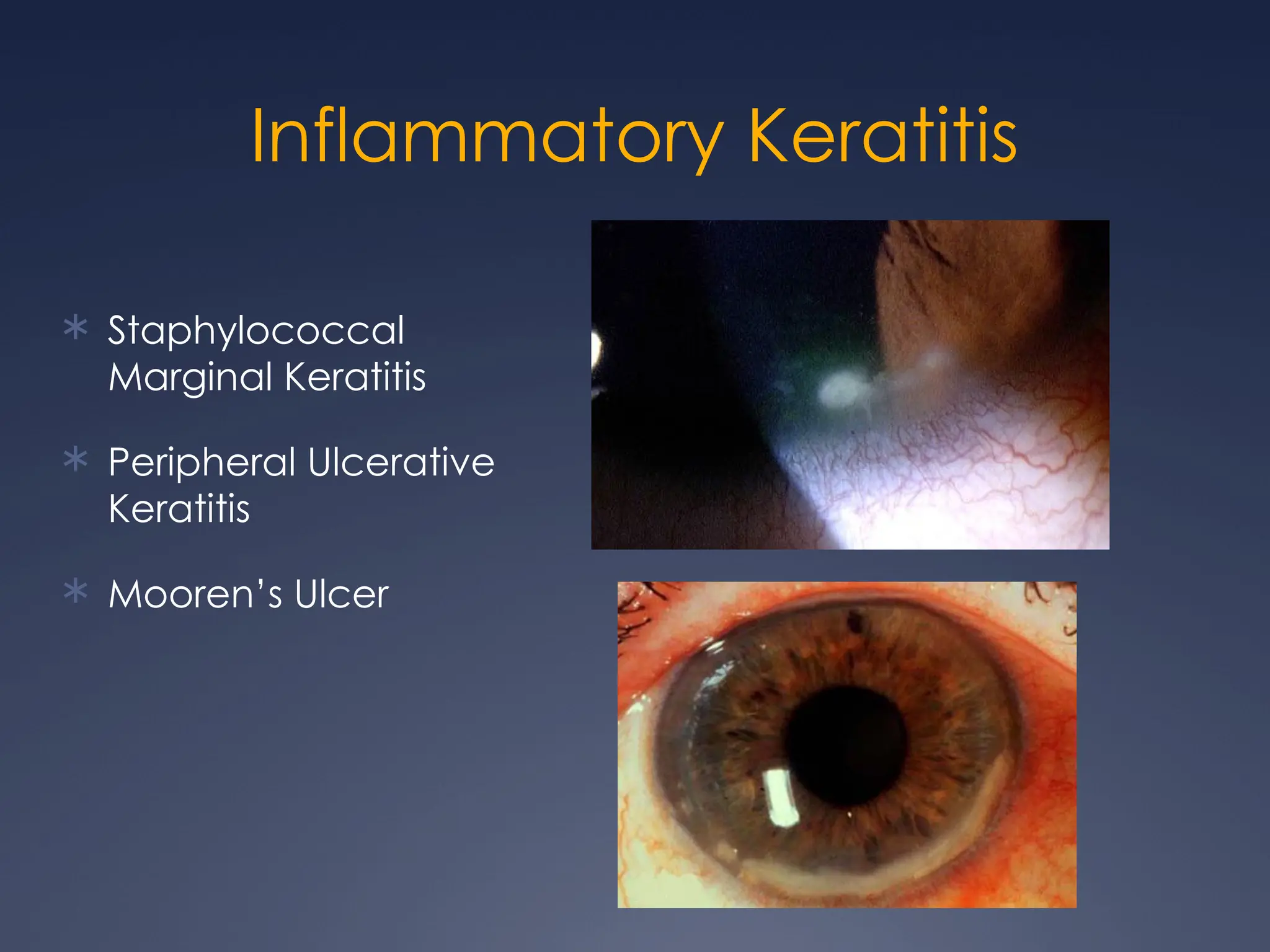 Cornea presentation including infectious disease | PPTX