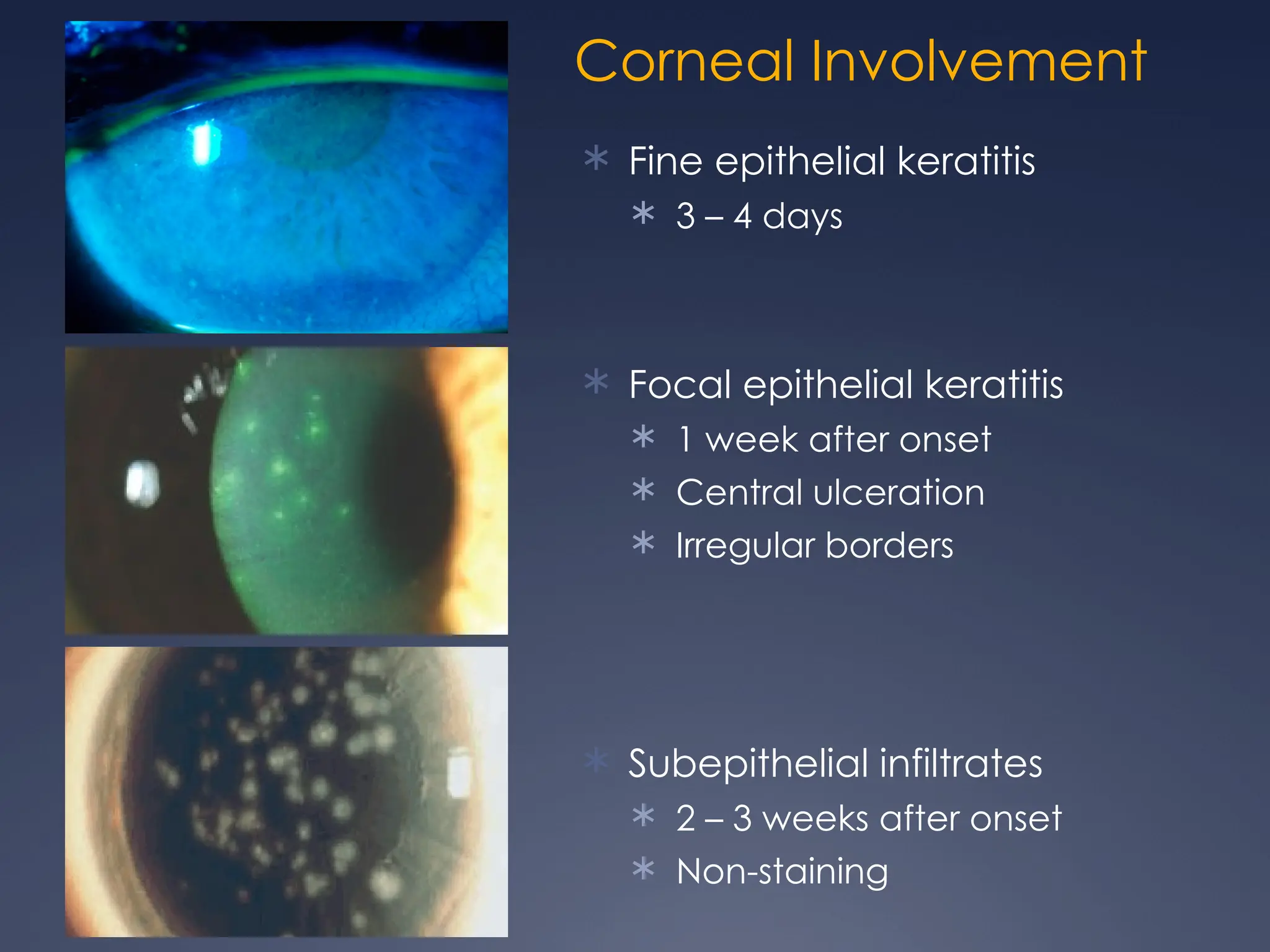 Cornea presentation including infectious disease | PPTX