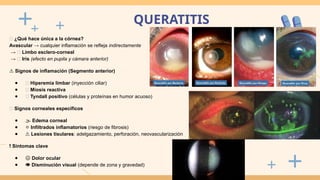 CORNEA Y ESCLERA EXPLICACION ANATOMICA Y FUNCION | PPTX