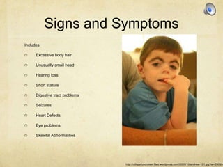 Cornelia De Lange Syndrome Karyotype