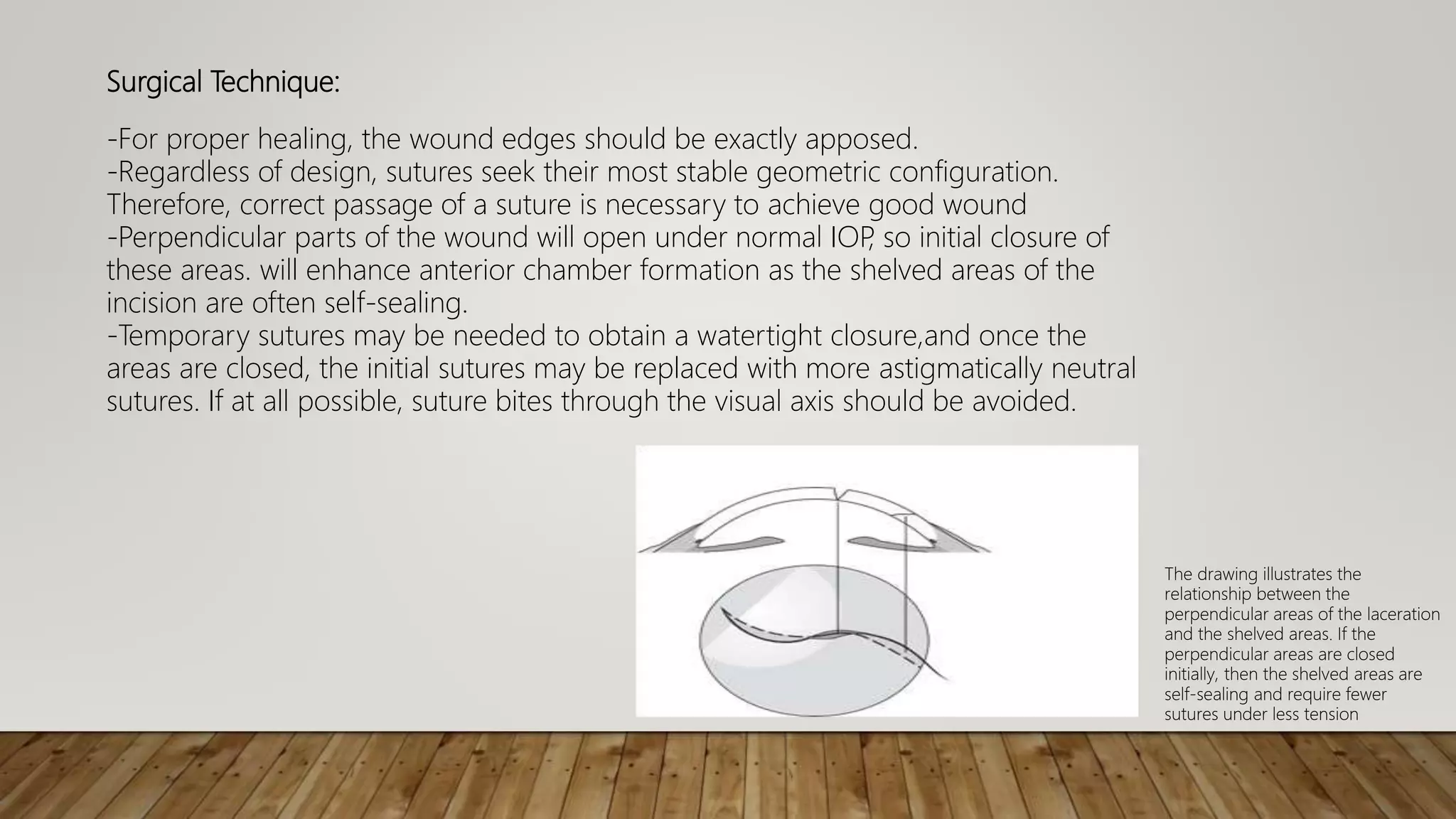 Corneo scleral trauma repair | PPTX