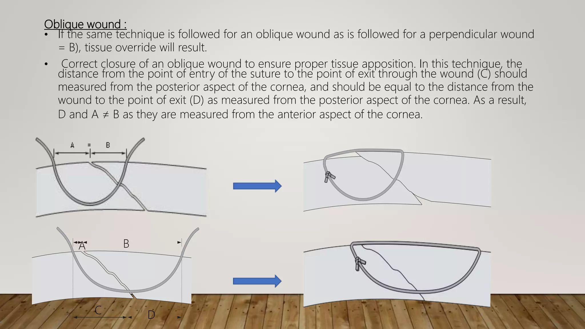 Corneo scleral trauma repair | PPTX
