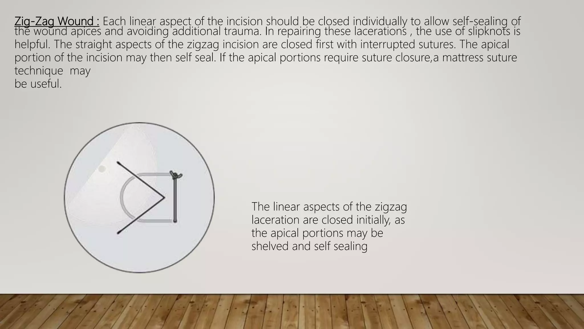 Corneo scleral trauma repair | PPTX