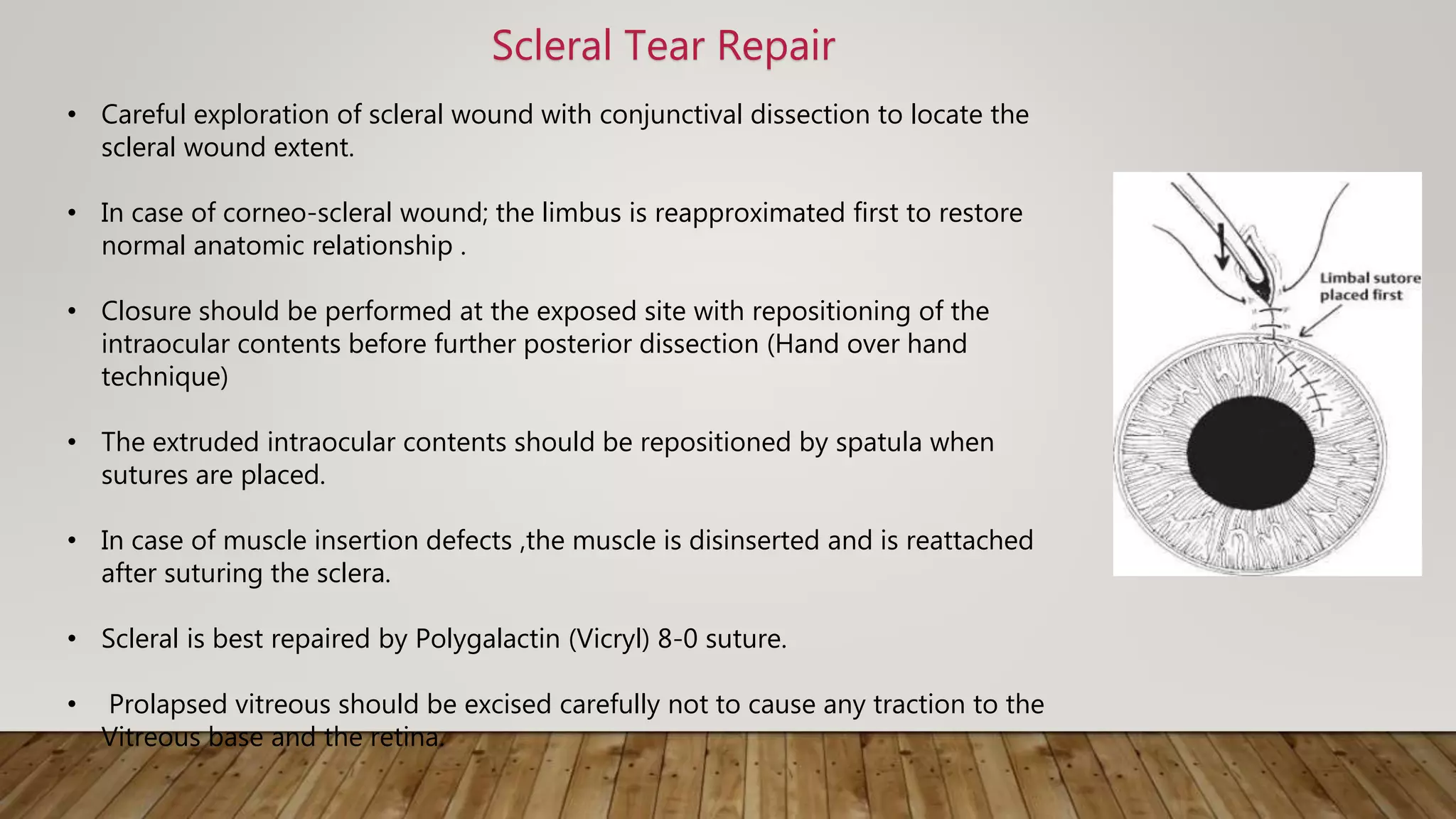 Corneo scleral trauma repair | PPTX