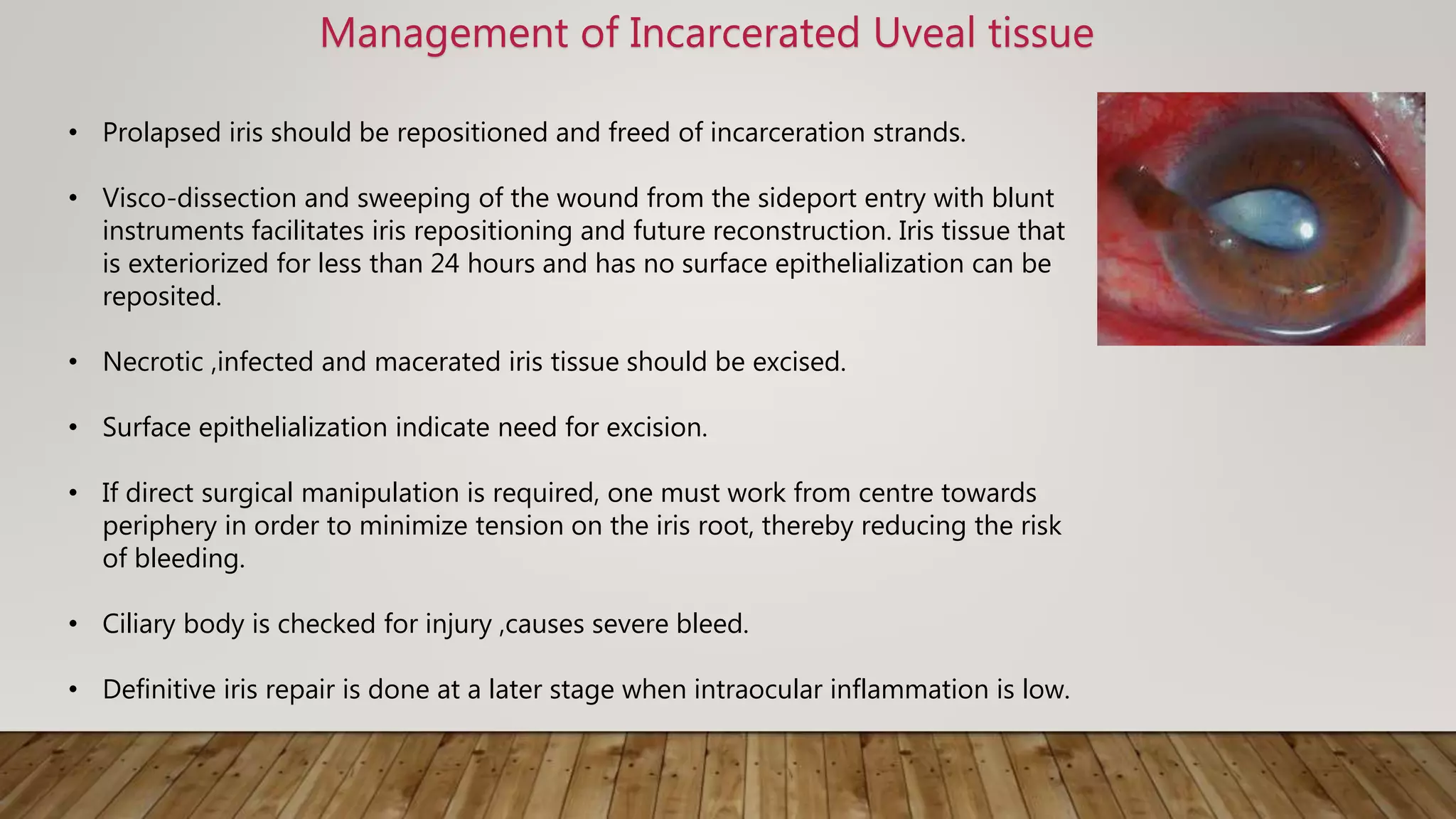 Corneo scleral trauma repair | PPTX