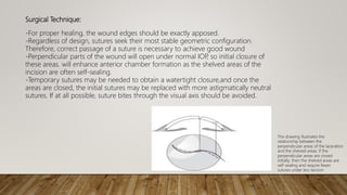 Corneo scleral trauma repair | PPTX