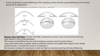 Corneo scleral trauma repair | PPTX