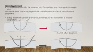 Corneo scleral trauma repair | PPTX