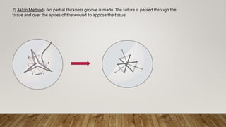 Corneo scleral trauma repair | PPTX