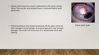 Corneo scleral trauma repair | PPTX