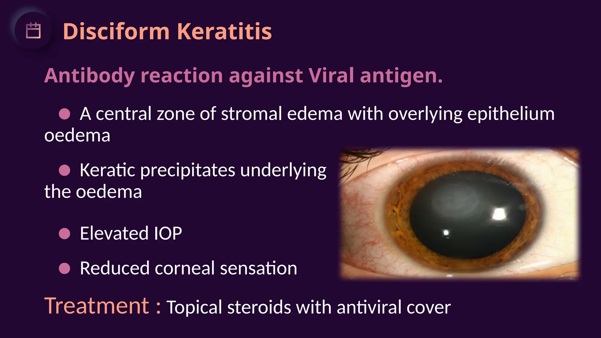 corneal,scleral and episcleral diseases.pptx