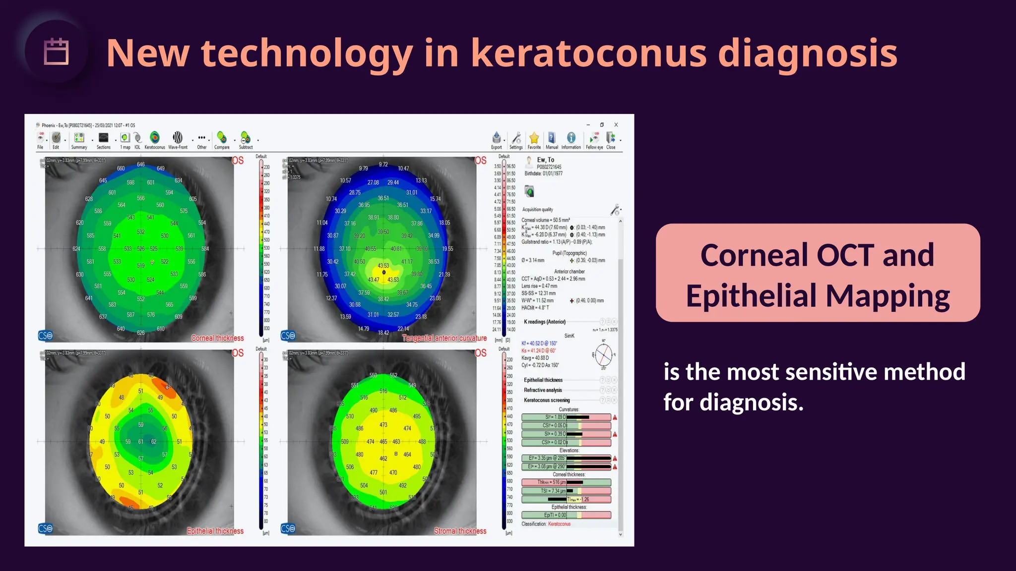 corneal,scleral and episcleral diseases.pptx