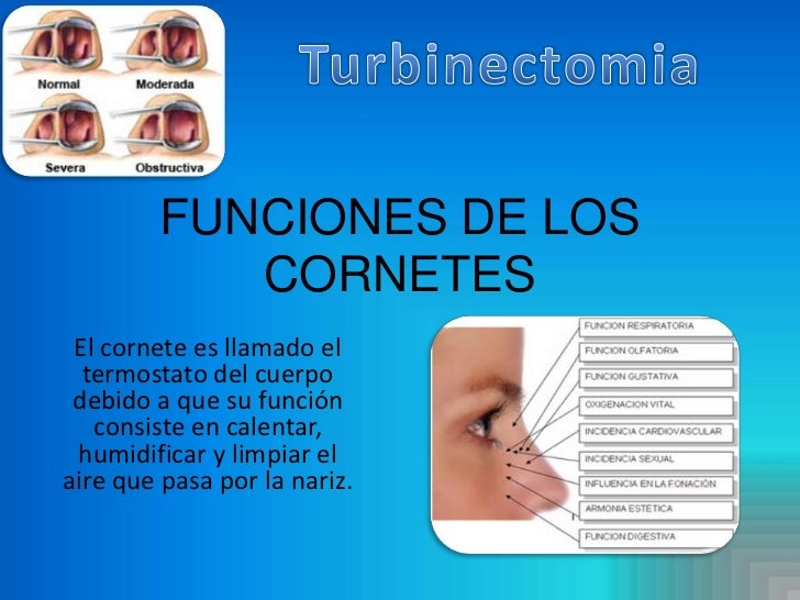 Cornetes nasales inferiores[1]