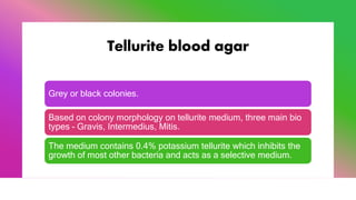 Corneybacterium diptheriae | PPTX