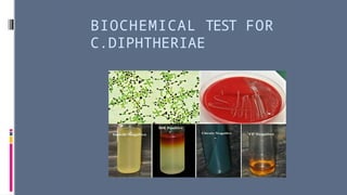 CORNYBACTERIUM DIPHTHERIA IN MEDICAL BACTERIOLOGY pptx | PPT