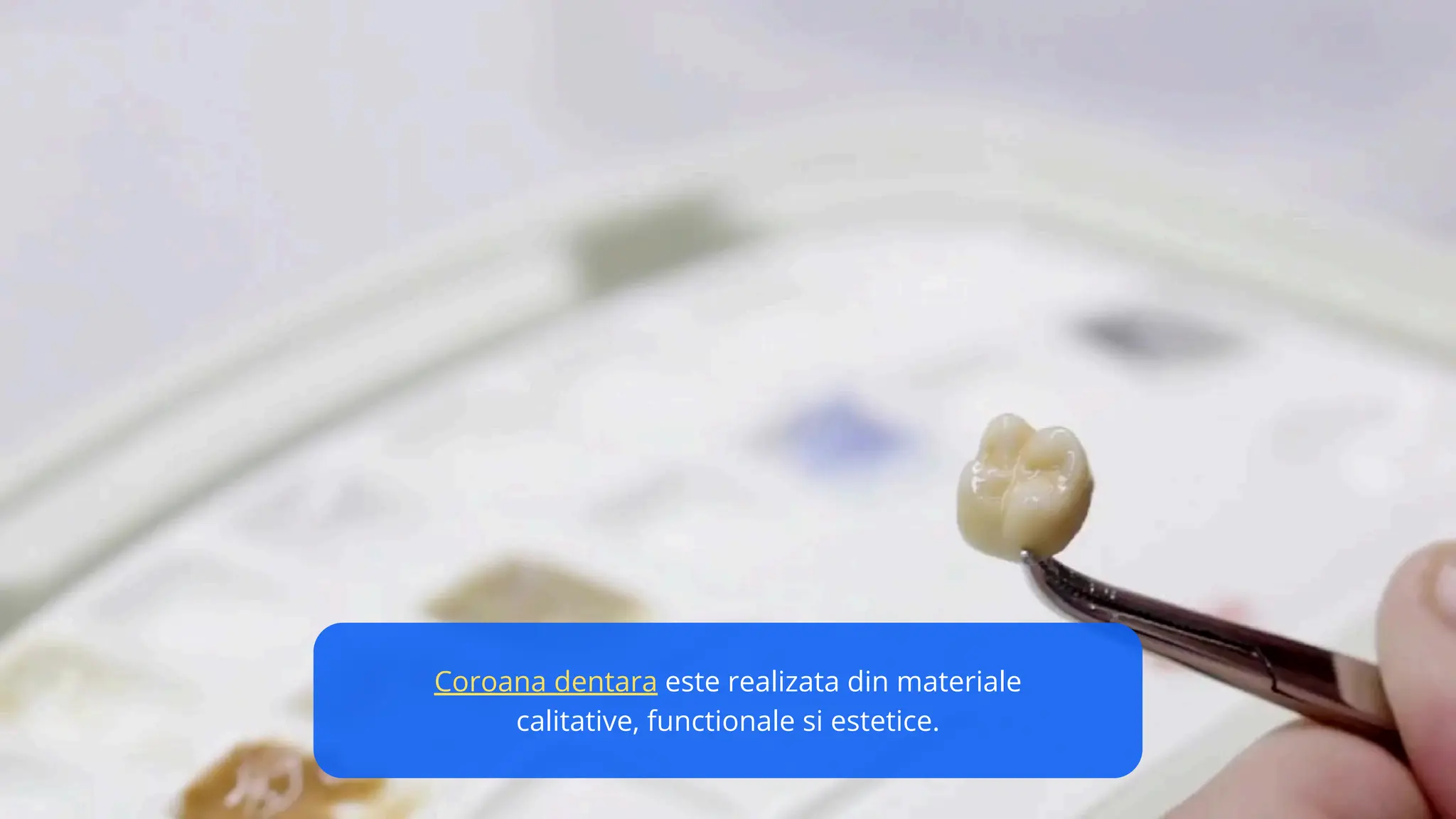 Coroana pe implant dentar - Tipuri si avantaje | PPT