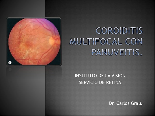 Coroiditis multifocal con_panuveitis