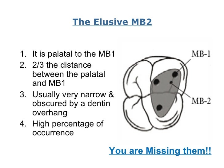 Coronal Cavity Preparation ‘Access’