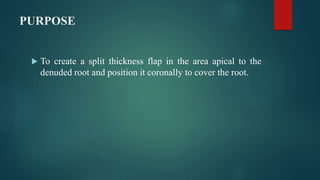 Coronal Positioned Pedicle Graft | PPTX