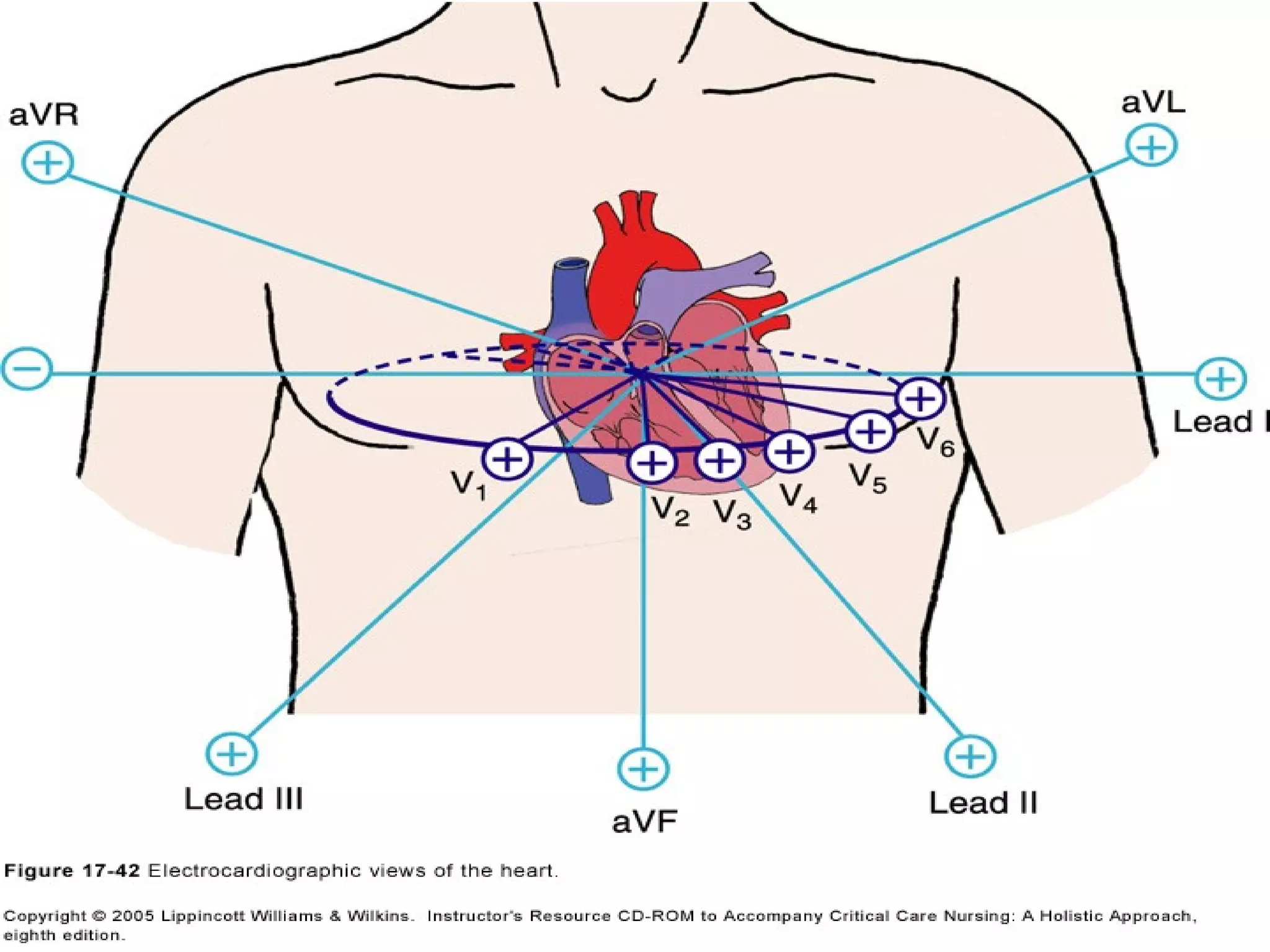 Coronary Arteries & 12-Leads | PPT