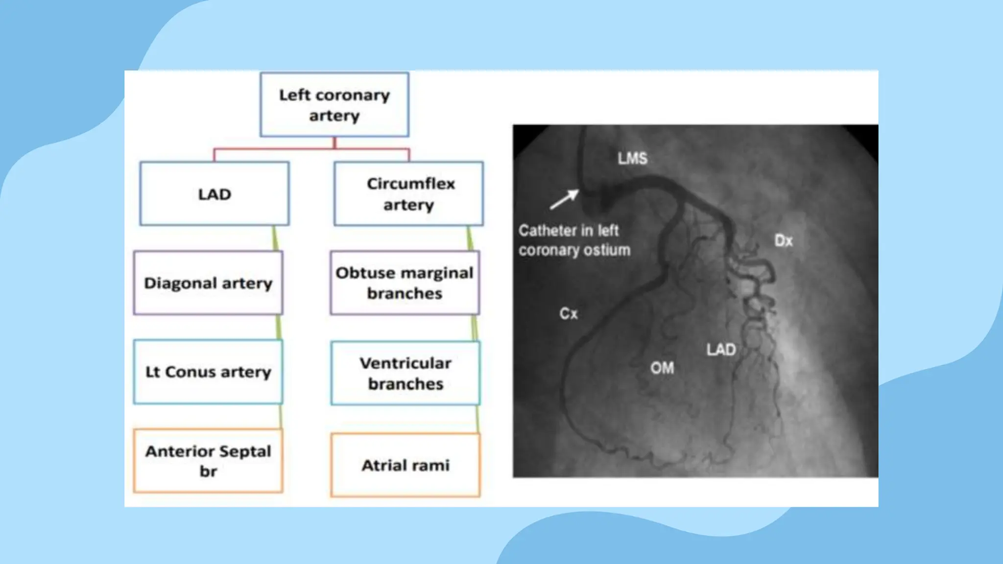 CORONARY__ANGIOGRAM-and-Angiography.pptx