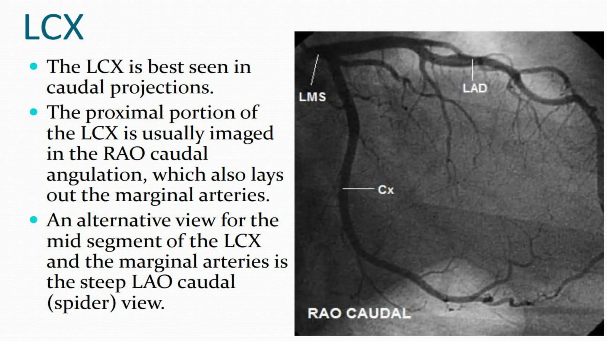 CORONARY__ANGIOGRAM-and-Angiography.pptx
