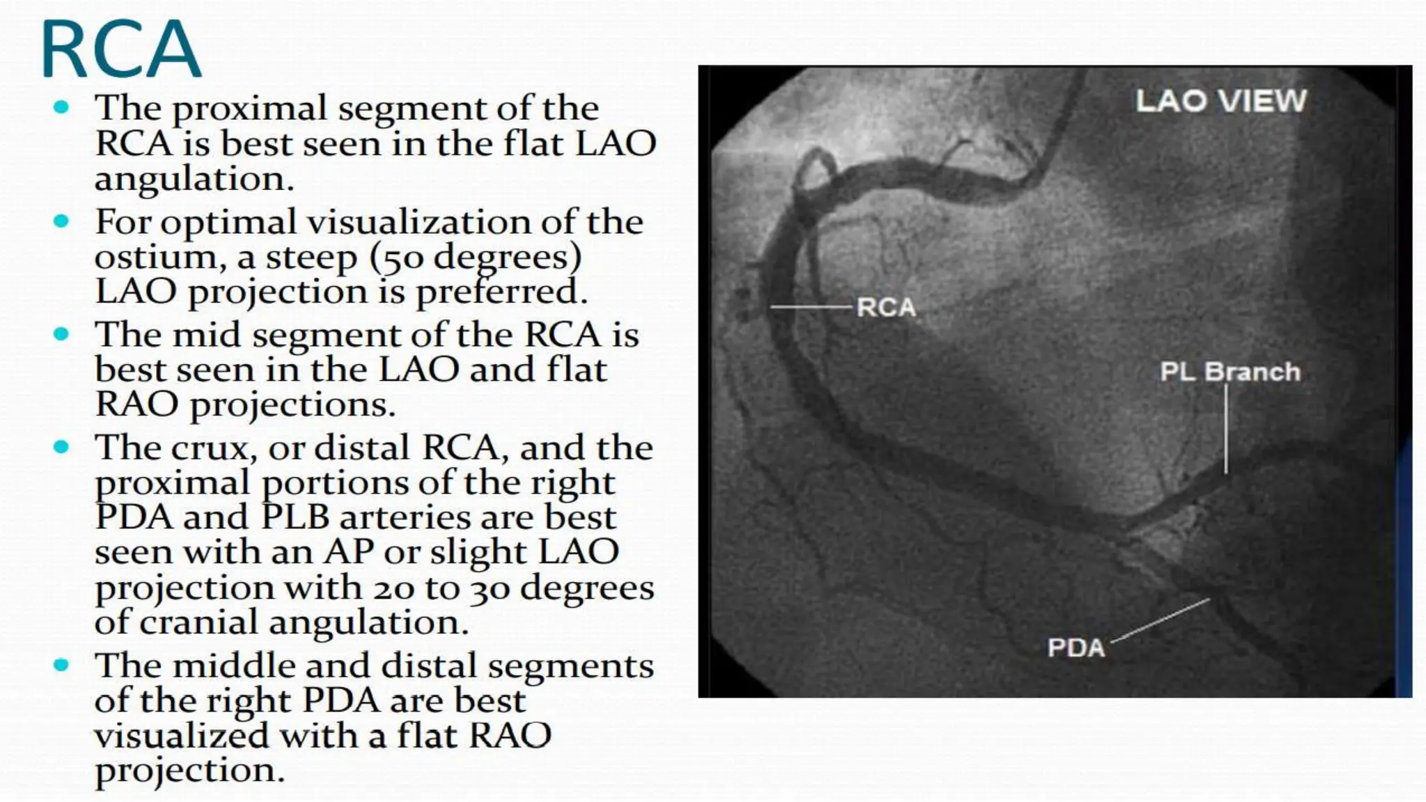 CORONARY__ANGIOGRAM-and-Angiography.pptx