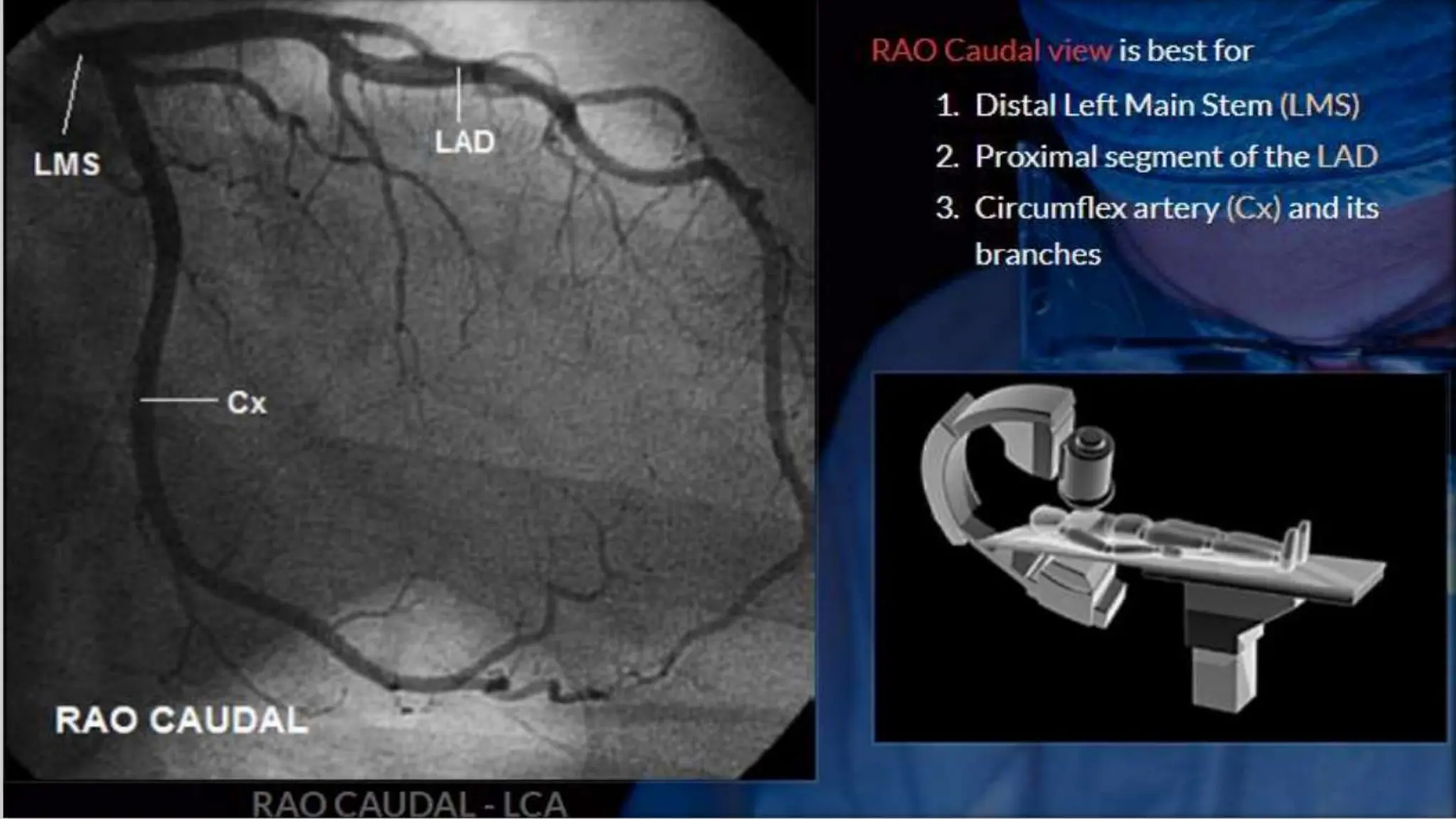 CORONARY__ANGIOGRAM-and-Angiography.pptx