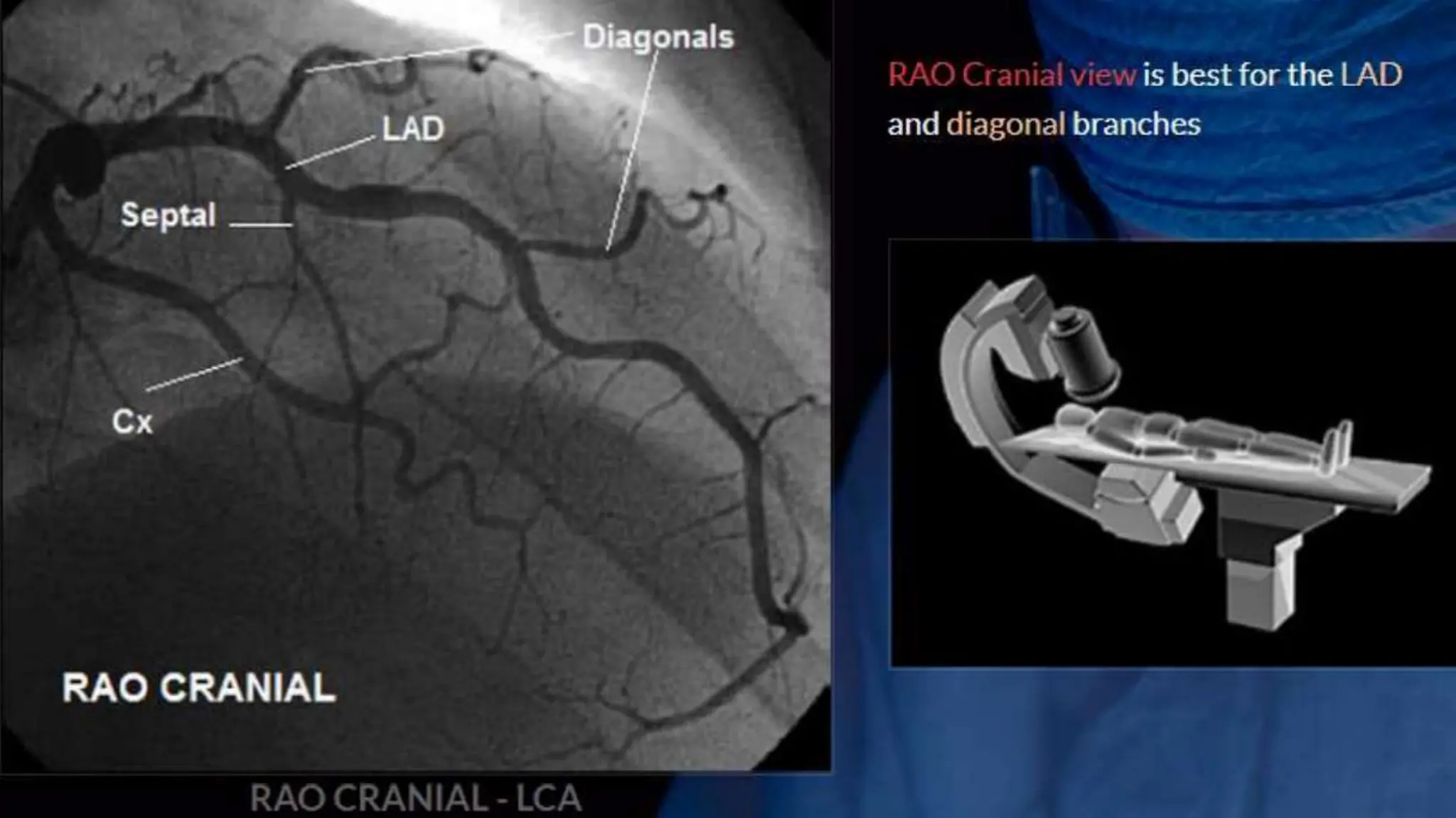 CORONARY__ANGIOGRAM-and-Angiography.pptx