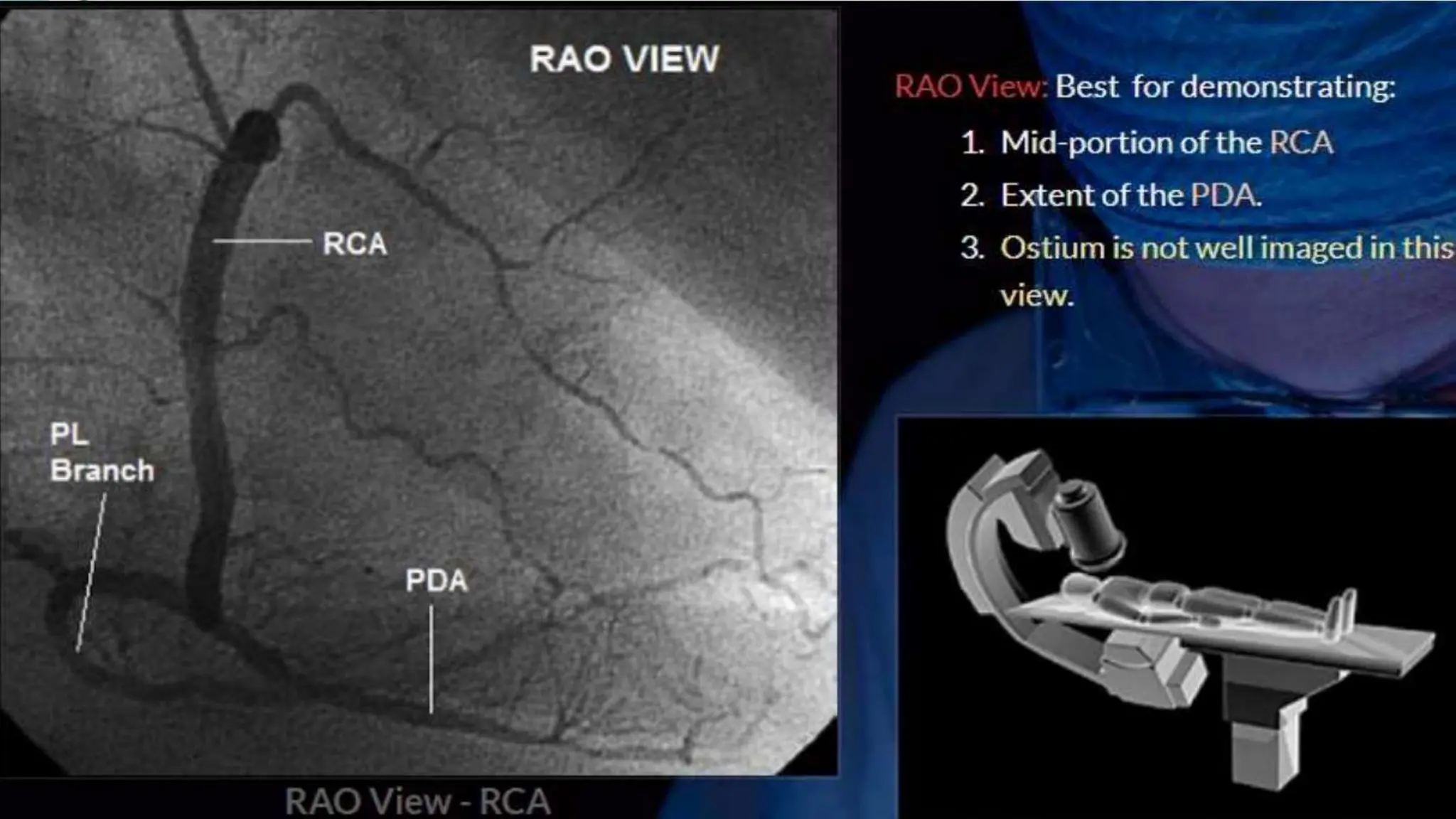 CORONARY__ANGIOGRAM-and-Angiography.pptx