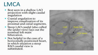 CORONARY__ANGIOGRAM-and-Angiography.pptx